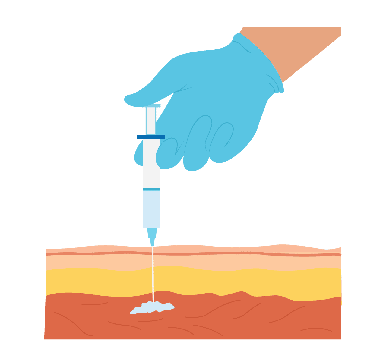 Intramuscular Injection (IM) : Everything You Need To Know